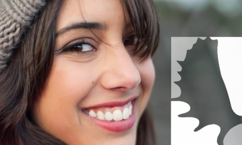 What Is a Gummy Smile, and What Are My Options To Fix It? - Valley ...