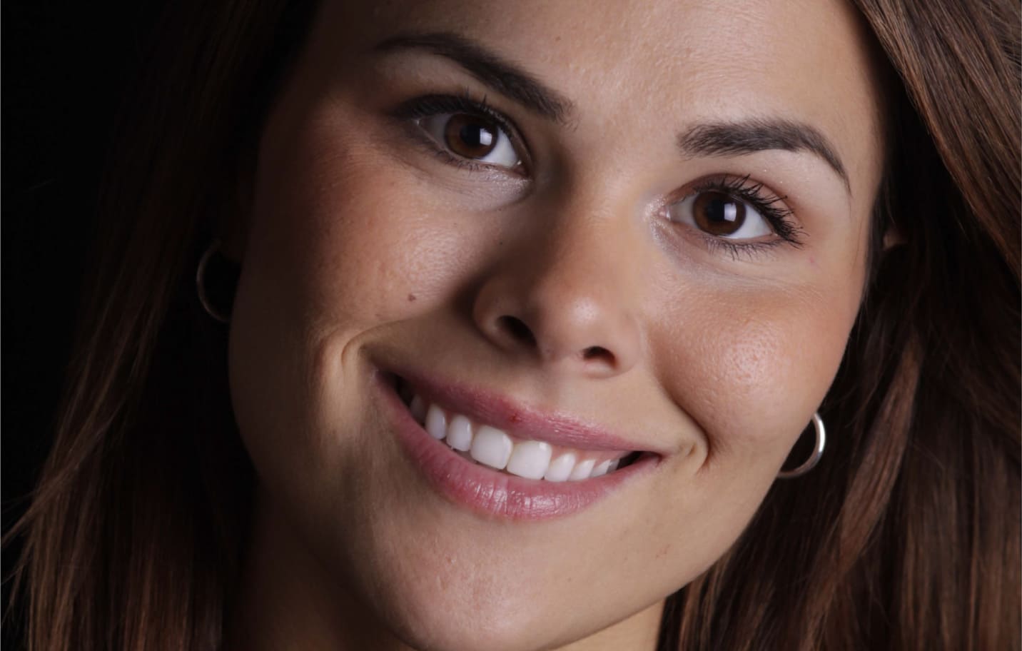 Short Teeth and a Gap | Luminous Smiles