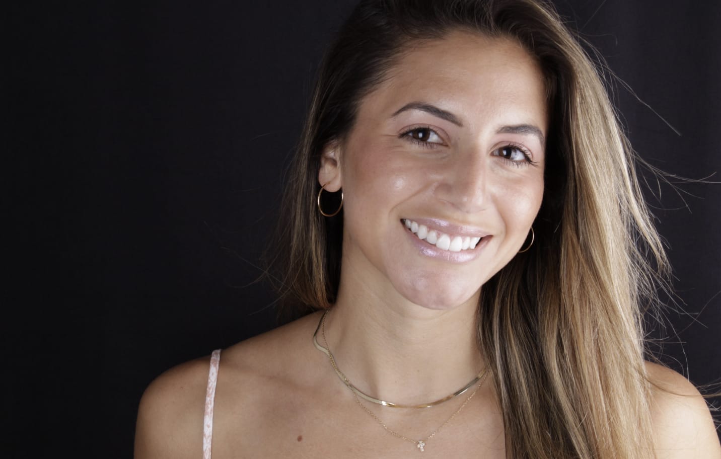 Jagged-edged Front Teeth | Luminous Smiles