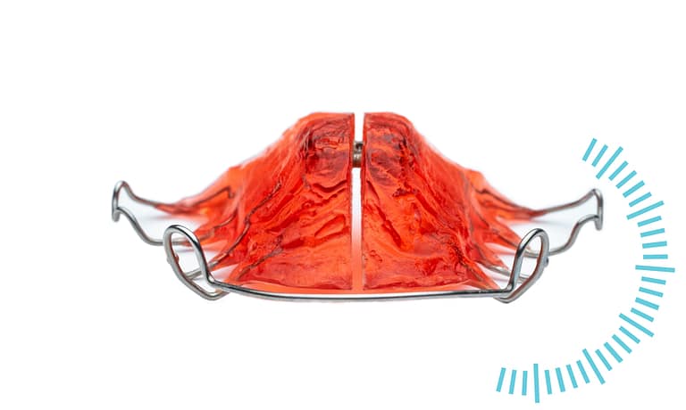 How Do Palatal Expanders Work and Who Needs Them?