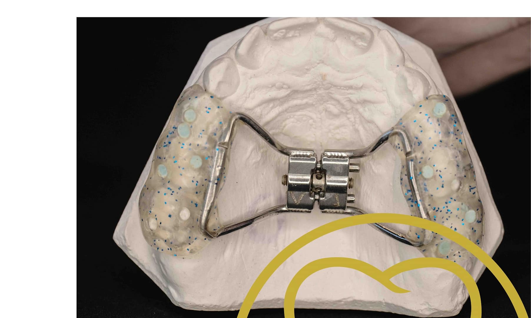 How Palatal Expanders Can Improve Your Child's Smile