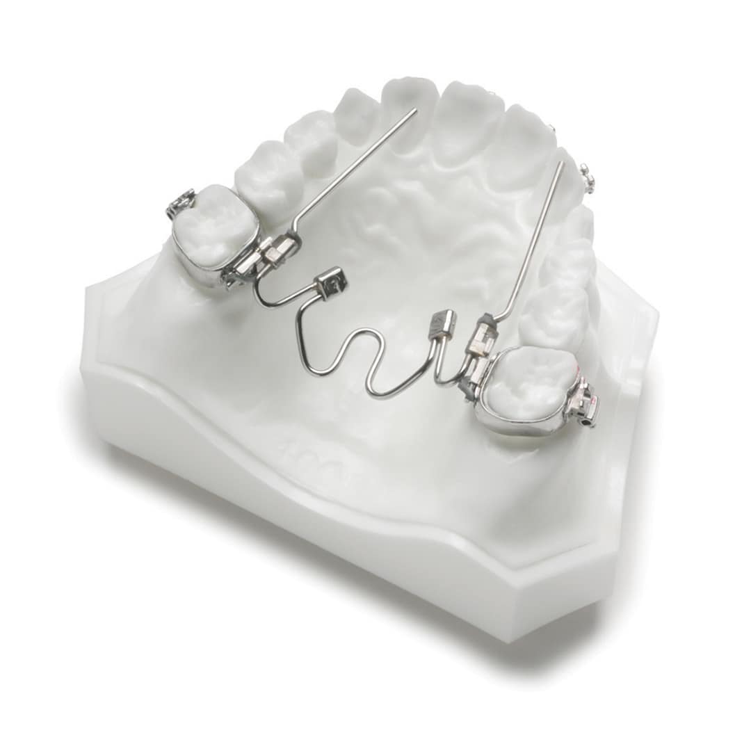 Niti Palatal Expander - Ortho Arch