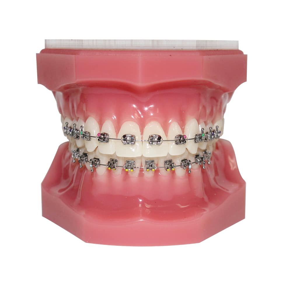 Bracketed Typodont - Ortho Arch