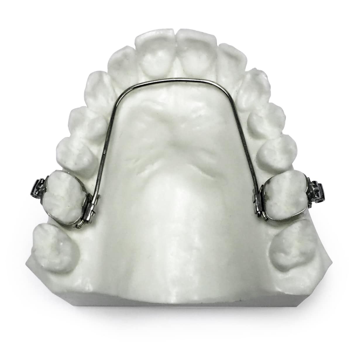 Fixed Lingual Controlled Arch – Ortho Arch