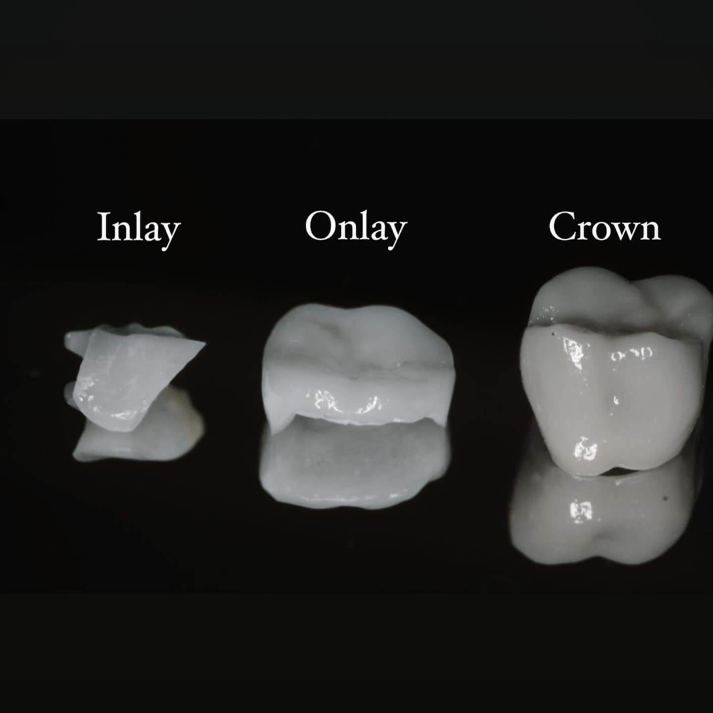 Biomimetic Dentistry - Oxley Comprehensive Dentistry