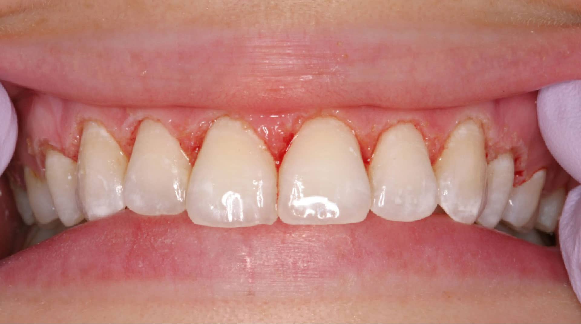 Cosmetic Dentistry - Dallas Cosmetic Dental - Dallas, TX