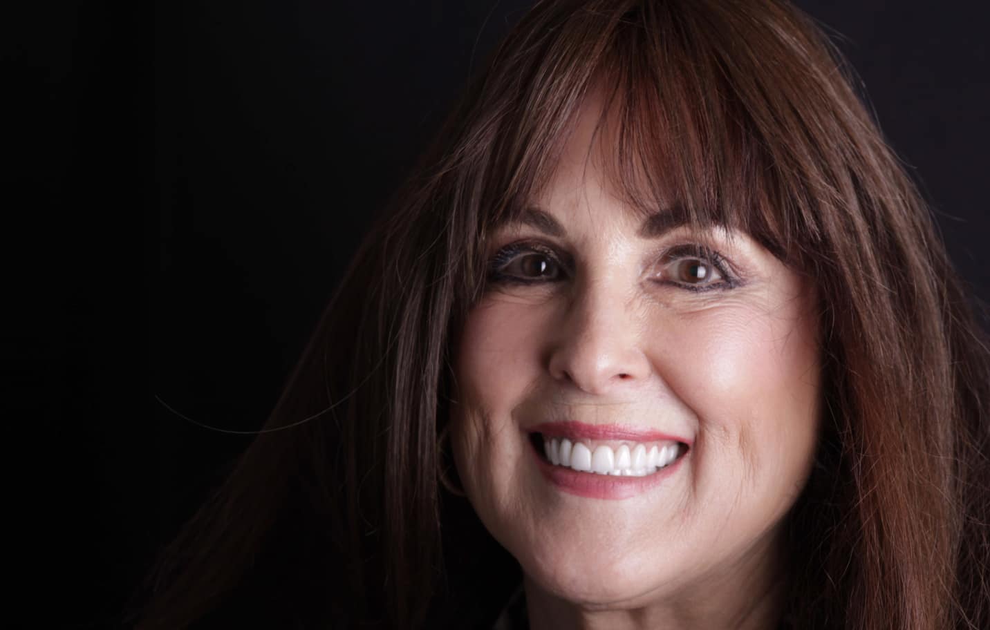 A Gummy Smile and Short Teeth | Luminous Smiles