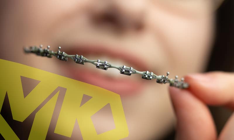 What’s it Like to Get Your Braces Taken Off? - Must Love Kids